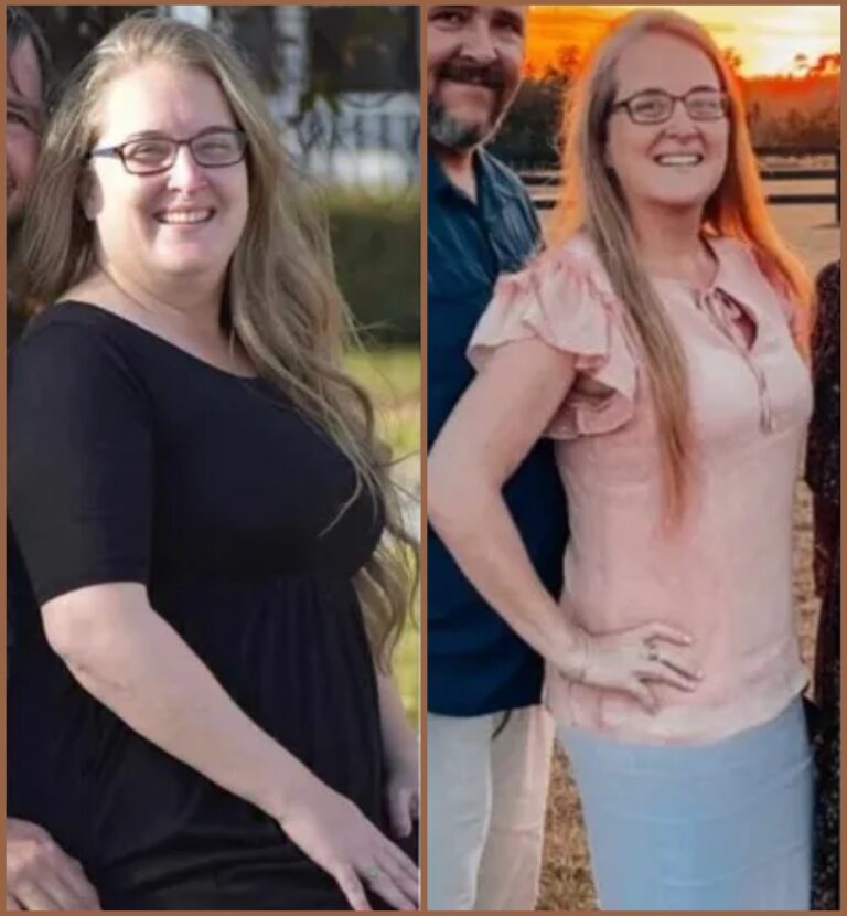 Before & After - Evolve Medical