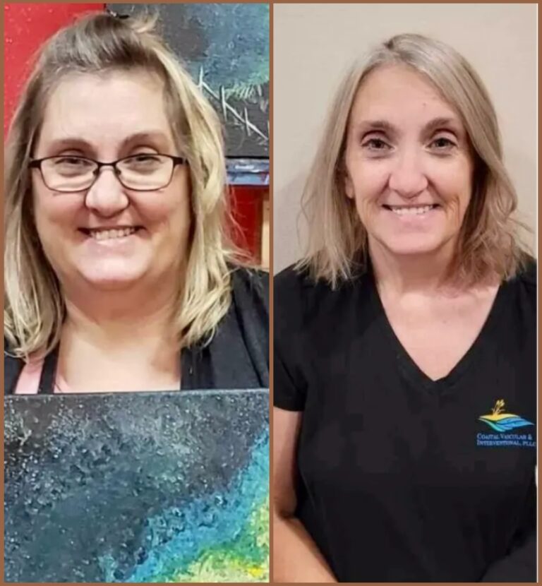 Before & After - Evolve Medical