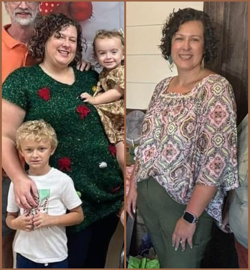 Before & After - Evolve Medical